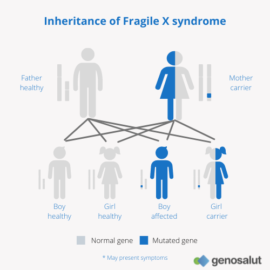 Fragile X syndrome in infertility, premature ovarian failure | Genosalut